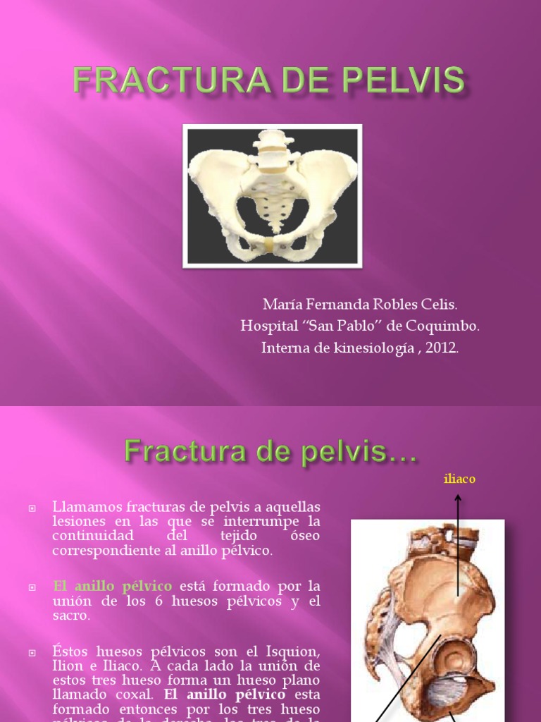 Fracturas de Pelvis. Presentacion. | PDF | Pelvis | Pierna humana