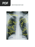 All Xray Views and Positions | PDF | Elbow | Anatomical Terms Of Motion