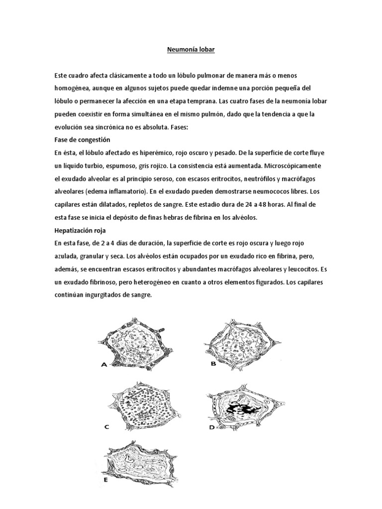 Fases Neumonia | PDF | Especialidades Medicas | Anatomía