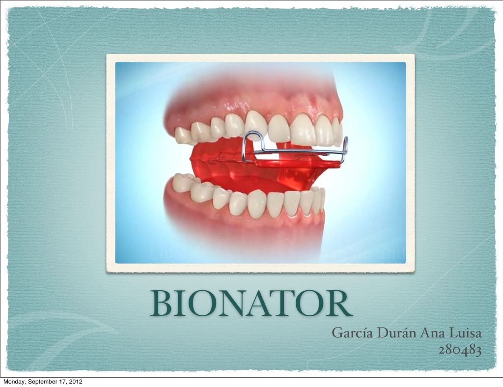 Bionator: Tipos y Aplicaciones Clínicas | PDF | Diente humano | Boca