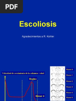 Signo de Risser | PDF | Escoliosis | Rtt
