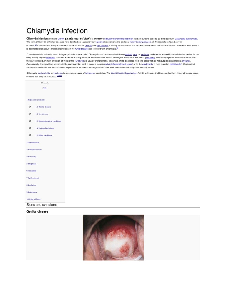 Chlamydia Infection | PDF | Medicine | Gynaecology