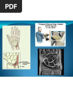 TFCC Lesions: Classification Guide | PDF | Joints | Human Anatomy