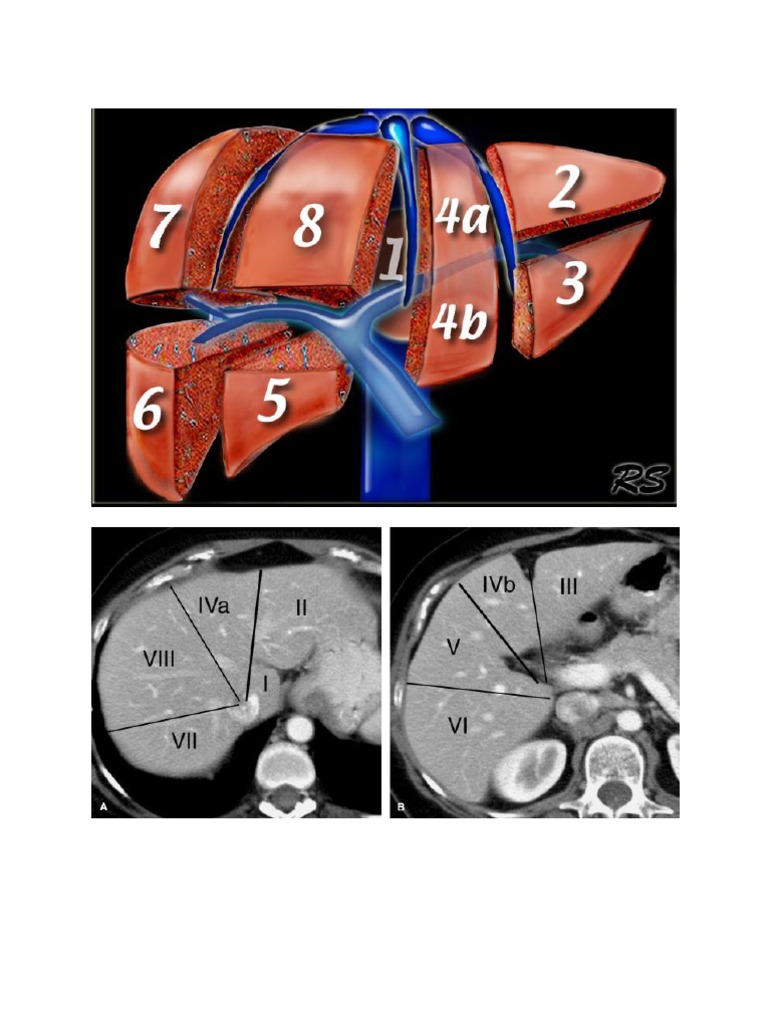 Couinaud Liver Segmentation Overview | PDF