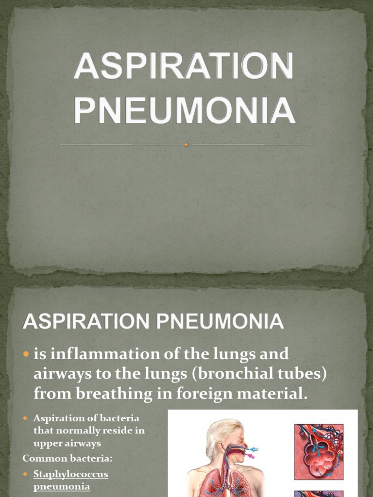 Aspiration Pneumonia | Respiratory Tract | Pneumonia