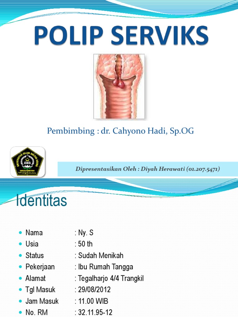 Polip Serviks - 14 September 2012 | PDF