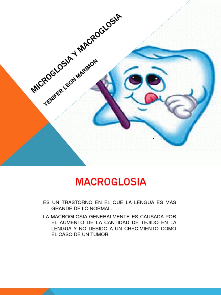 Microglosia y Macroglosia