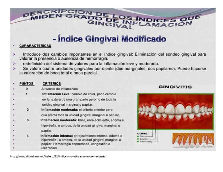 Indice Gingival Modificado | PDF