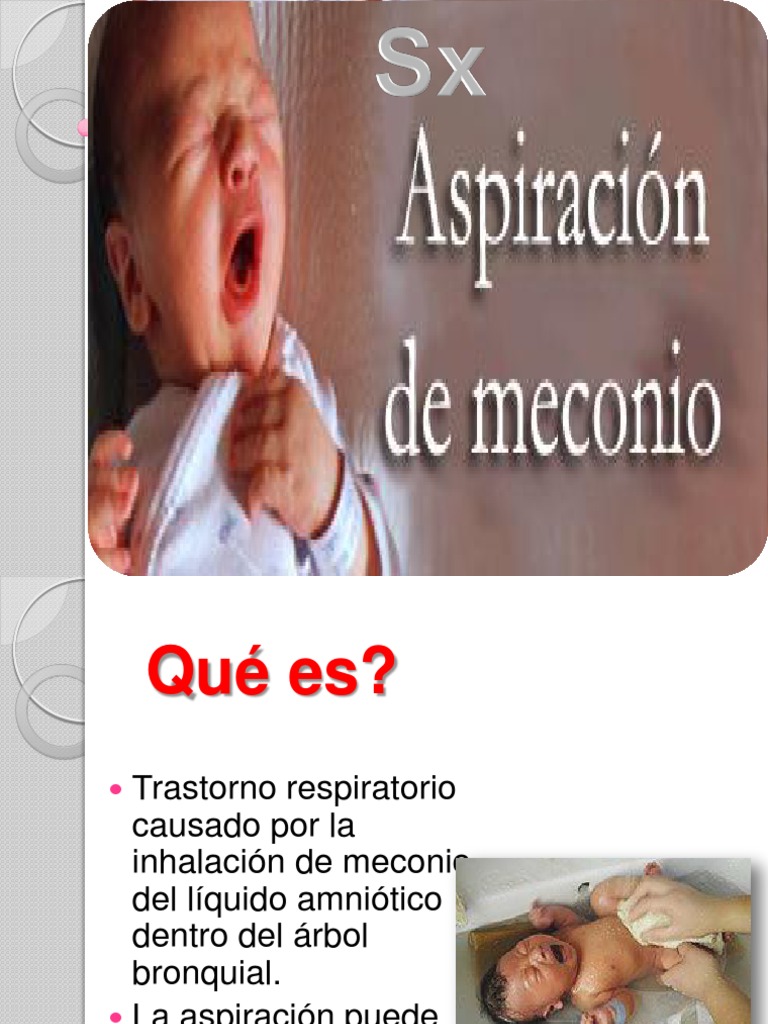 Sindrome de Aspiraciòn de Meconio | PDF | Sistema respiratorio | Infantes