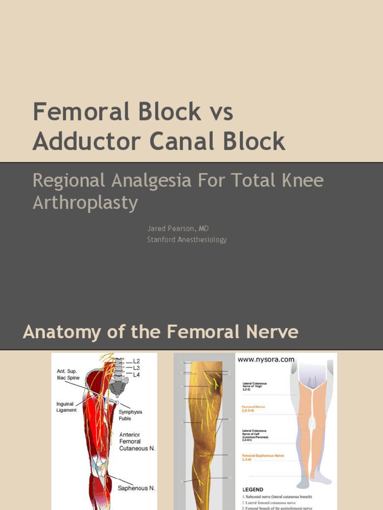 Femoral Block Vs Adductor Canal Block: Regional Analgesia For Total ...