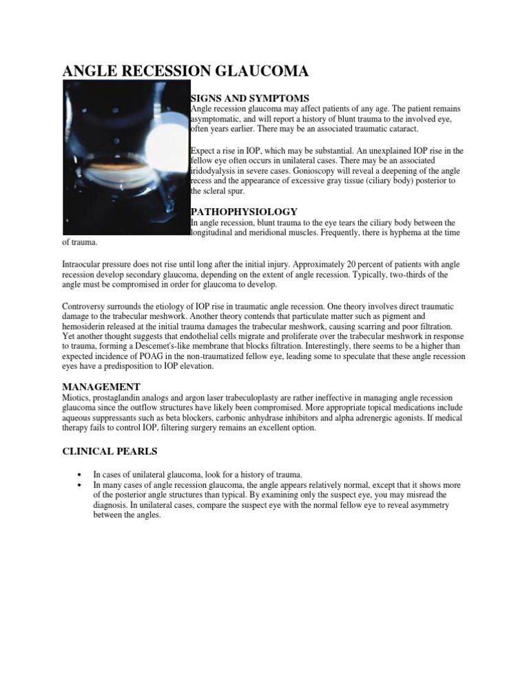 Angle Recession Glaucoma | PDF | Glaucoma | Ophthalmology