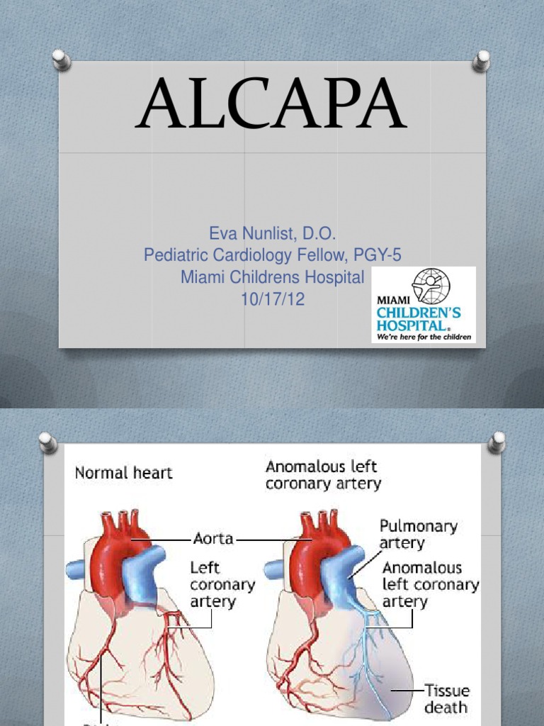 Alcapa Final | PDF | Coronary Circulation | Heart Failure
