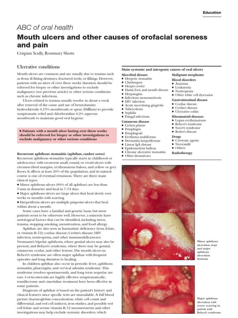 Mouth Ulcers and Other Causes of Orofacial Soreness and Pain | PDF ...