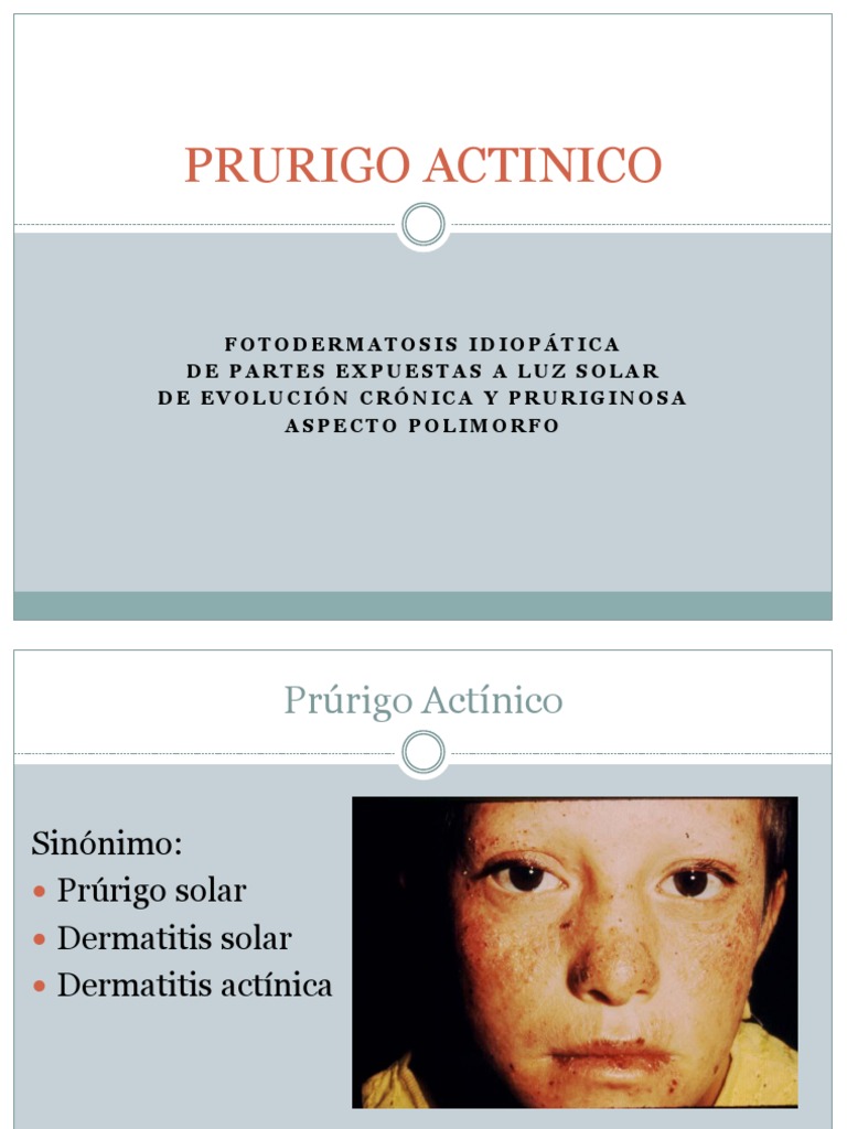 Prurigo Actinico | PDF | Salud y bienestar