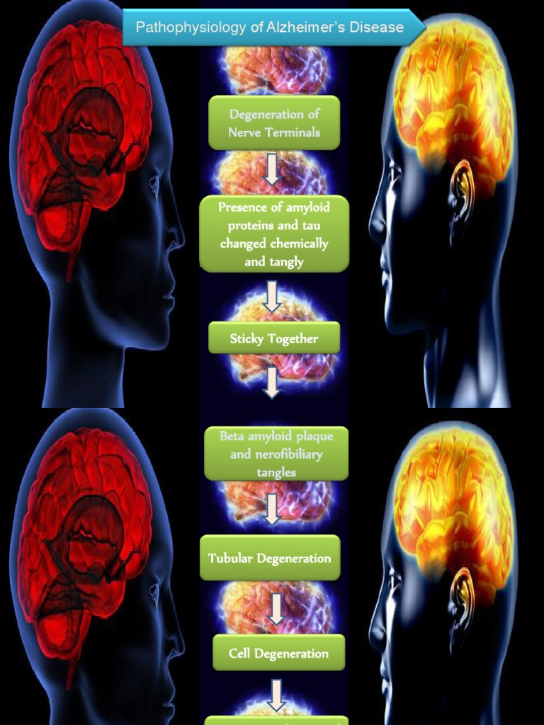 Alzheimer Pathophysiology | PDF