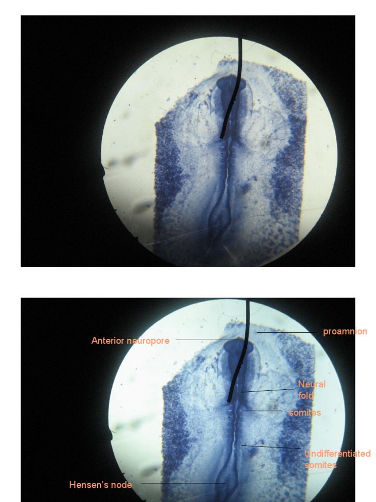 24 Hour Chick Embryo | PDF