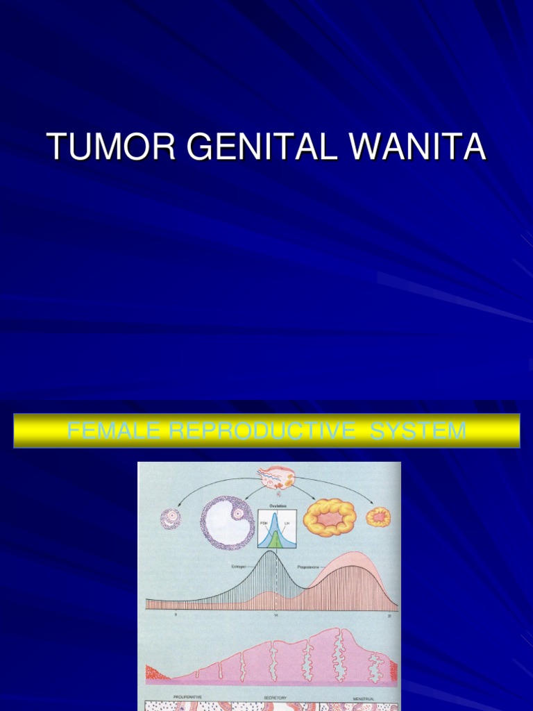 Female Reproductive Tumors Overview | PDF | Ovarian Cancer | Cervical ...