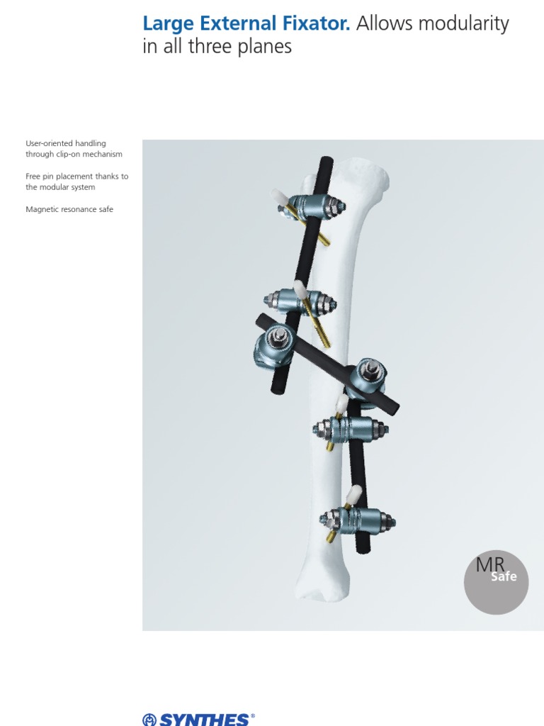 Large External Fixator.: Allows Modularity in All Three Planes | PDF ...