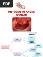 Distocia Funicular: Definición y Evaluación | PDF | Parto | Feto