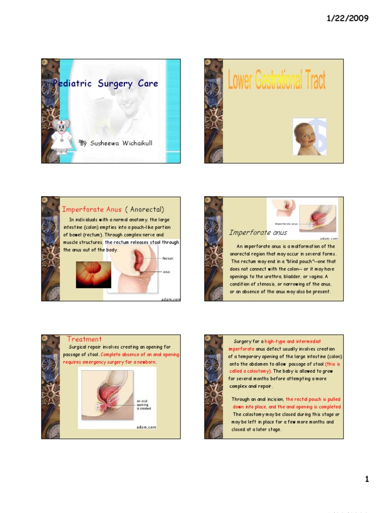 Pediatric Surgery Care: Imperforate Anus | PDF | Large Intestine | Rectum