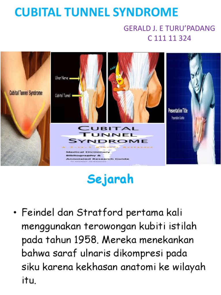 Cubital Tunnel Syndrome | PDF | Sains & Matematika | Sejarah