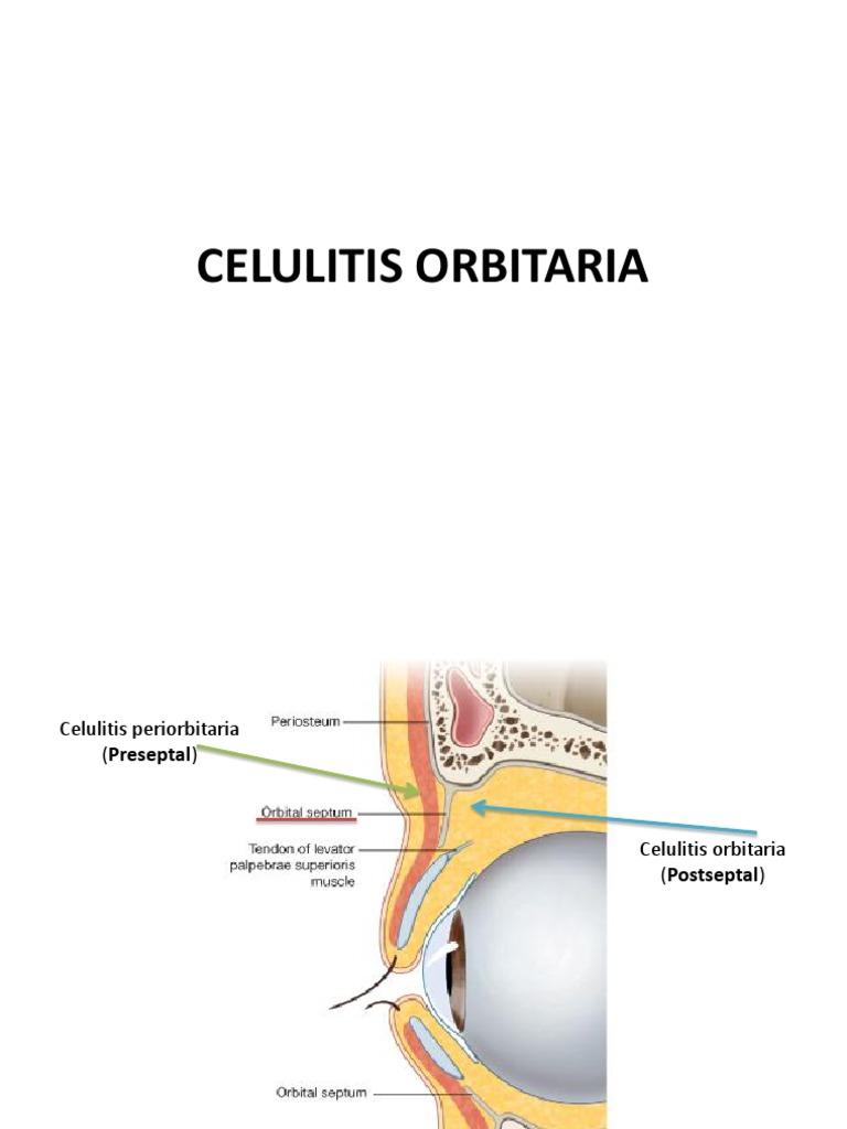 Diferencias entre celulitis preseptal y orbitaria | PDF | Microbiología ...