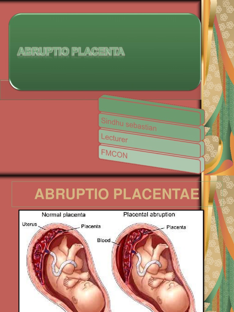 Abruptio Placenta | Bleeding | Childbirth