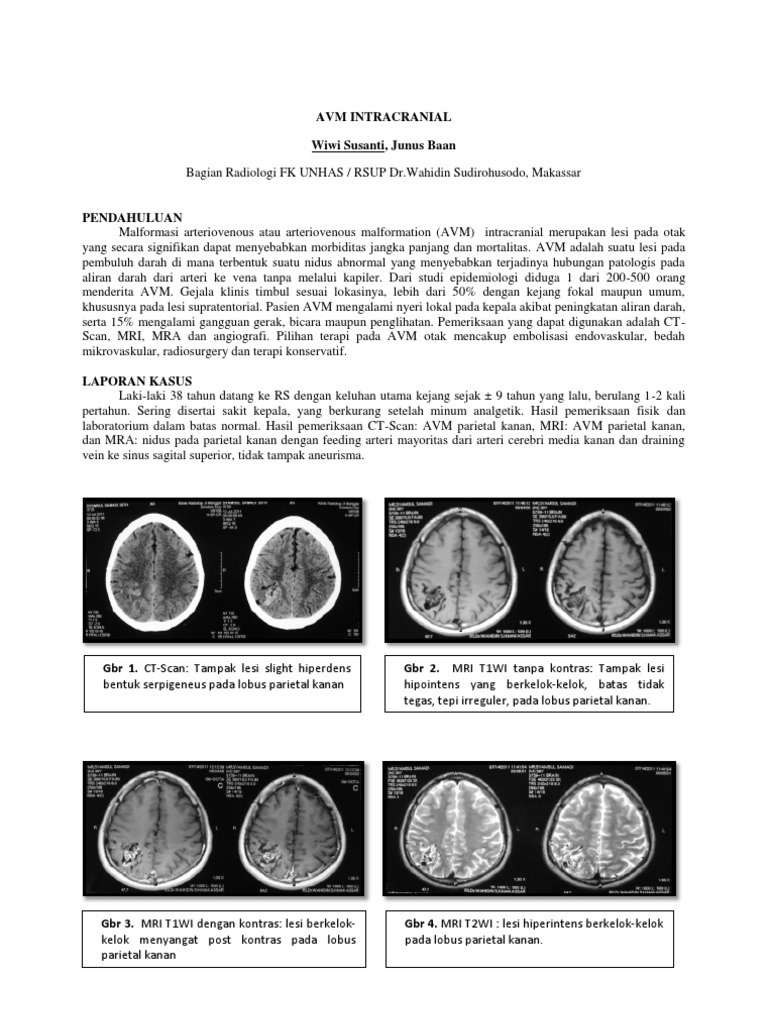 Avm Intracranial Format Poster Pdf