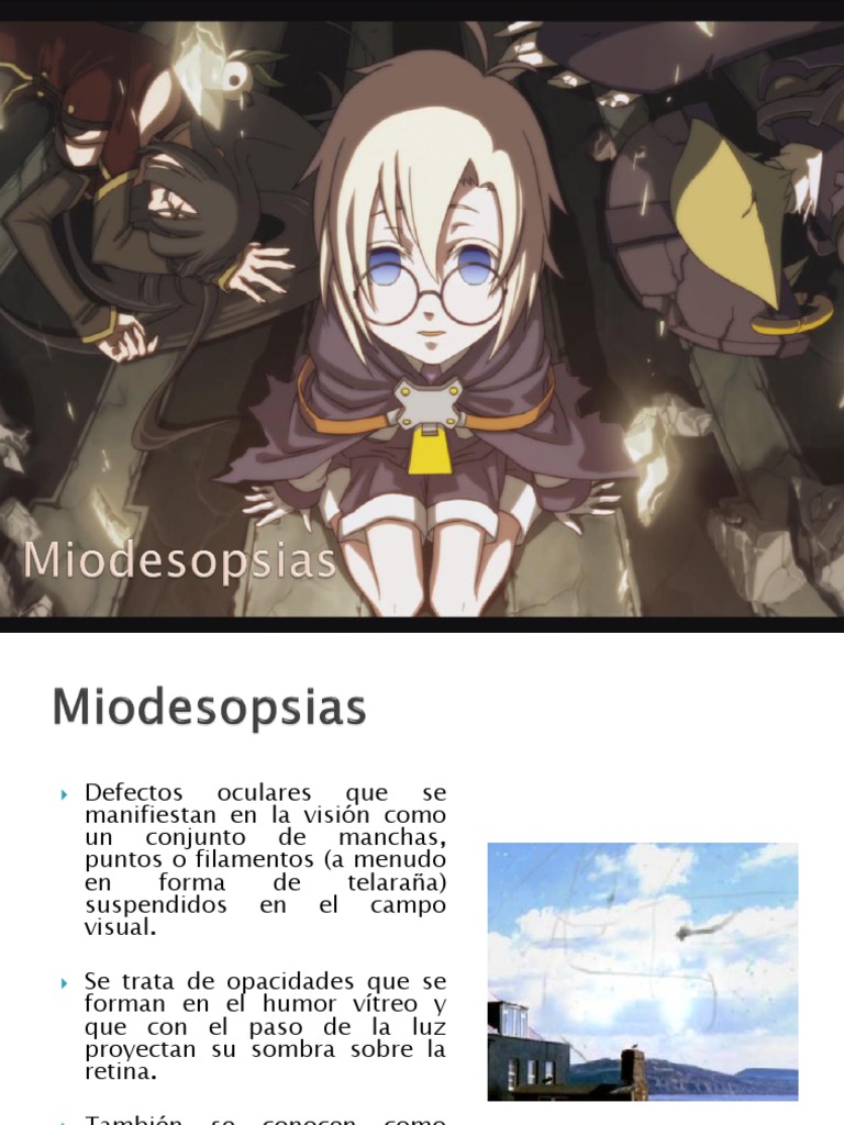 Miodesopsias | PDF | Visión | Oftalmología