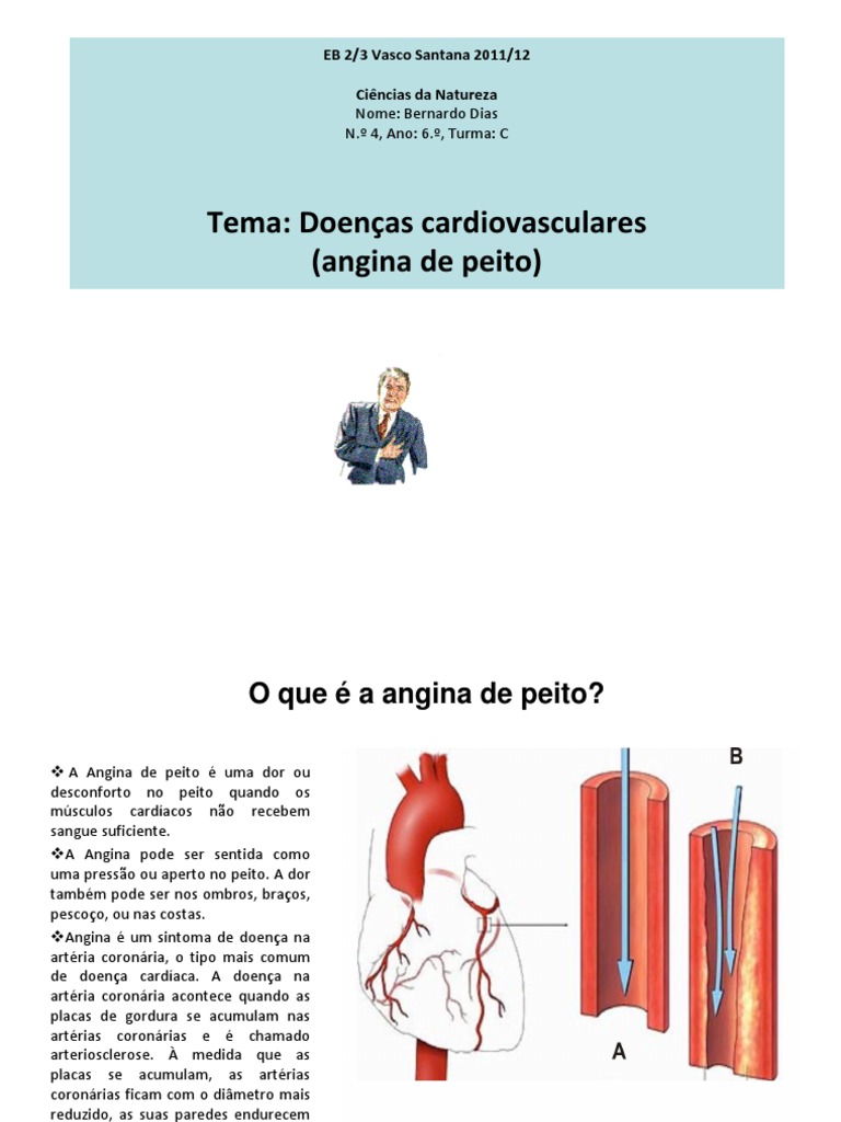 Angina de Peito Final | PDF | Angina Pectoris | Remédio