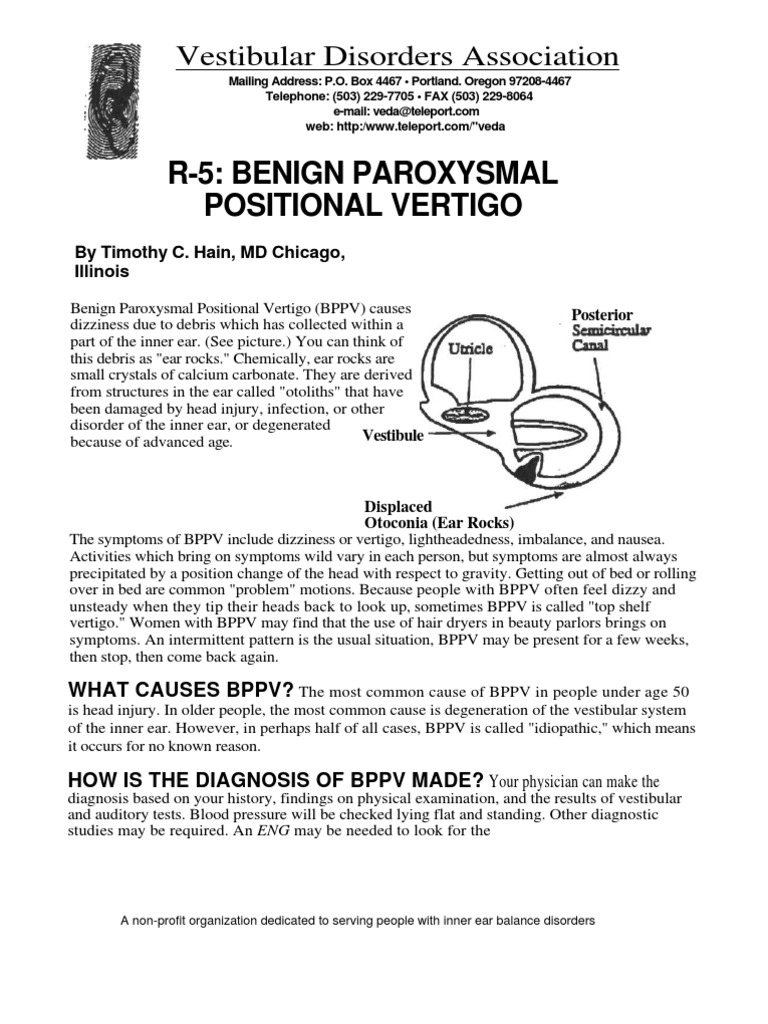 Vertigo BPPV Benign Vertigo | Vertigo | Neurology
