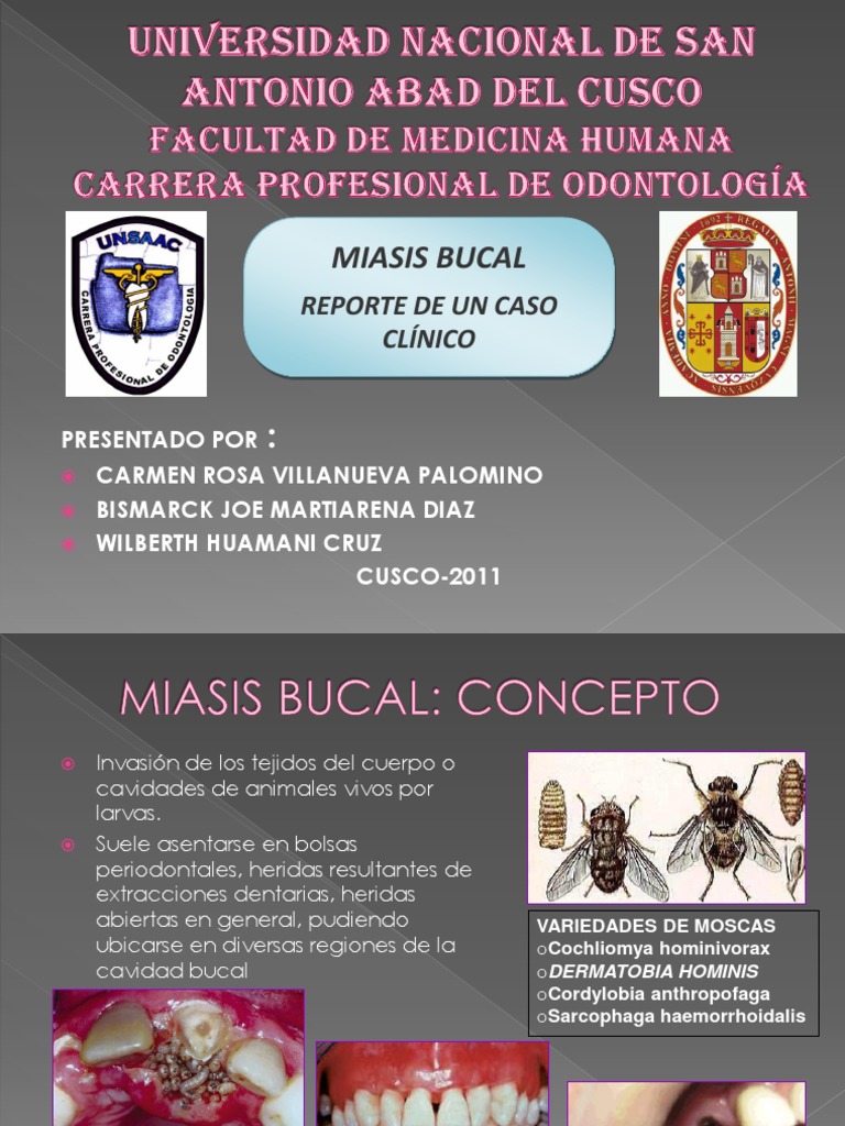 Exposicion Miasis | PDF | Diente humano | Medicina CLINICA