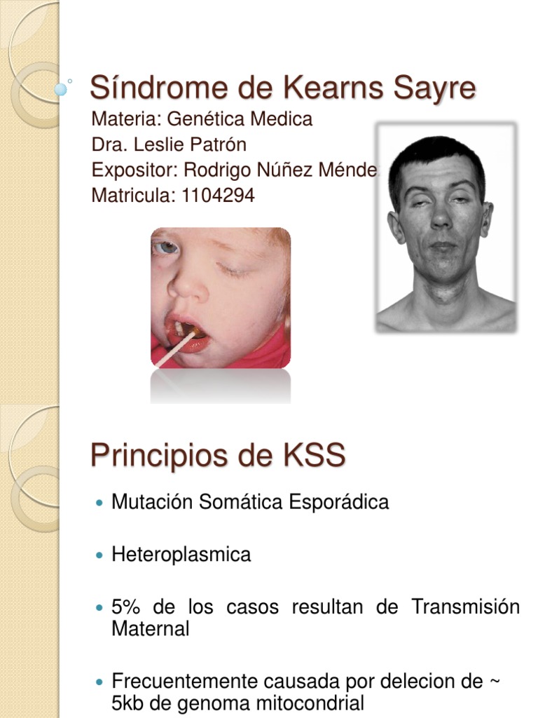 Síndrome de Kearns Sayre: Características y Diagnóstico | PDF ...
