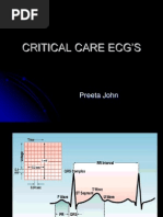 ECG Essentials for Paramedics | PDF | Electrocardiography ...