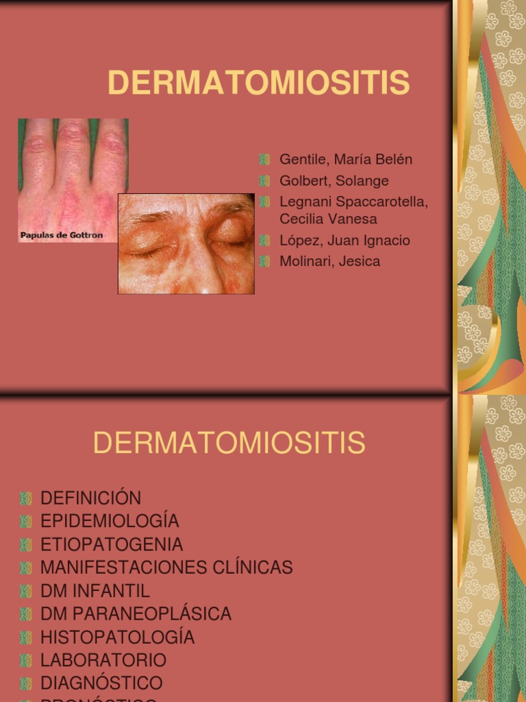 Dermatomiositis Final | Enfermedades y trastornos | Especialidades Medicas