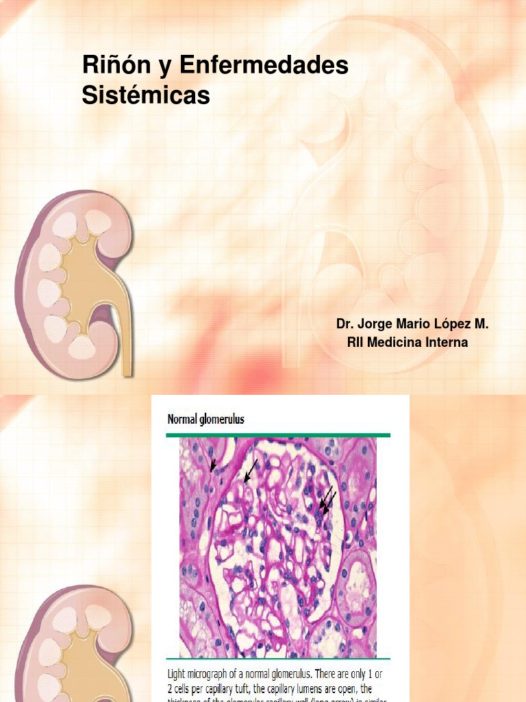 RIÑON Y ENFERMEDADES SISTEMICAS | Virus de la hepatitis C | Artritis ...