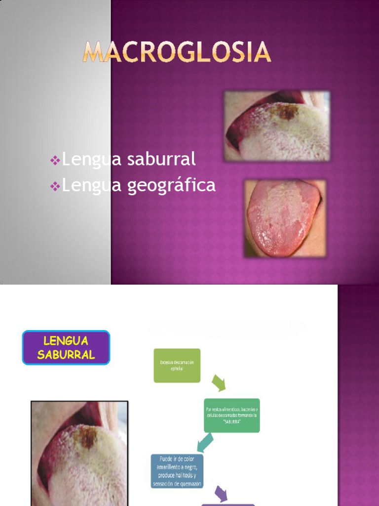 Macroglosia | PDF | Artes del Lenguaje y Comunicación