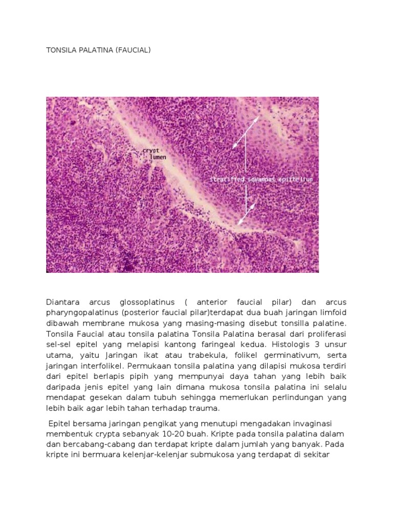 Tonsila Palatina | PDF