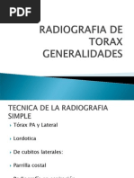 INTERPRETACION DE RX TORAX AP, PA Y LATERAL | PDF | Pulmón | Tórax ...