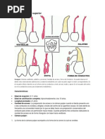 Clasificacion de Vertucci | PDF | Diente | Anatomia dental