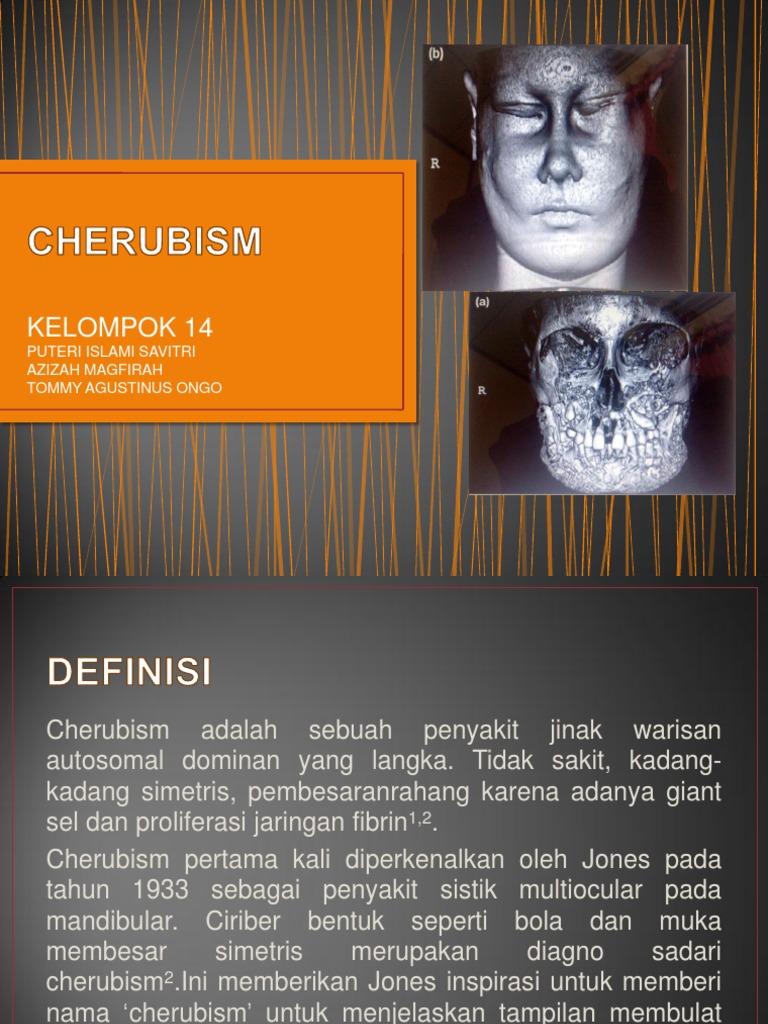 CHERUBISM | PDF