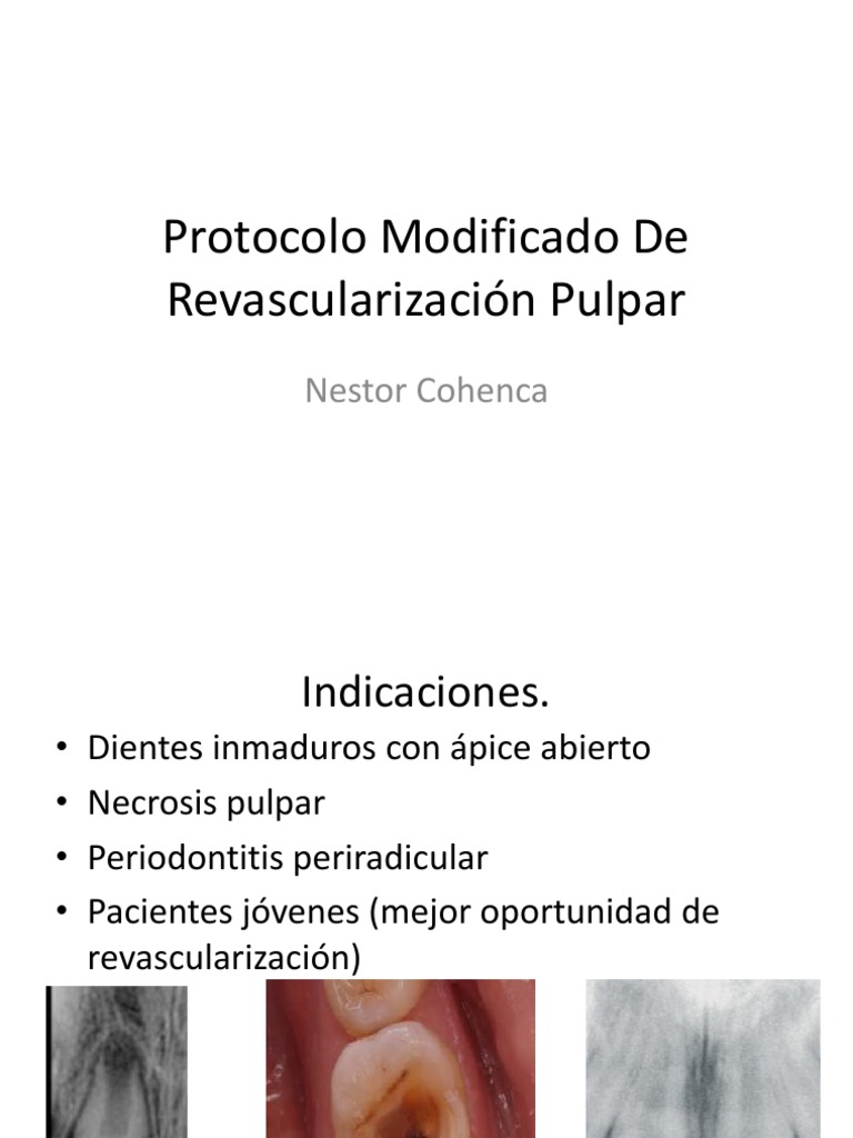 Protocolo Modificado de Revascularización Pulpar | PDF | Medicamentos con receta ...