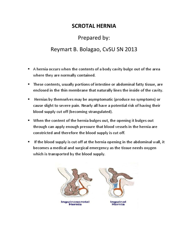 Scrotal Hernia | PDF | Clinical Medicine | Medicine