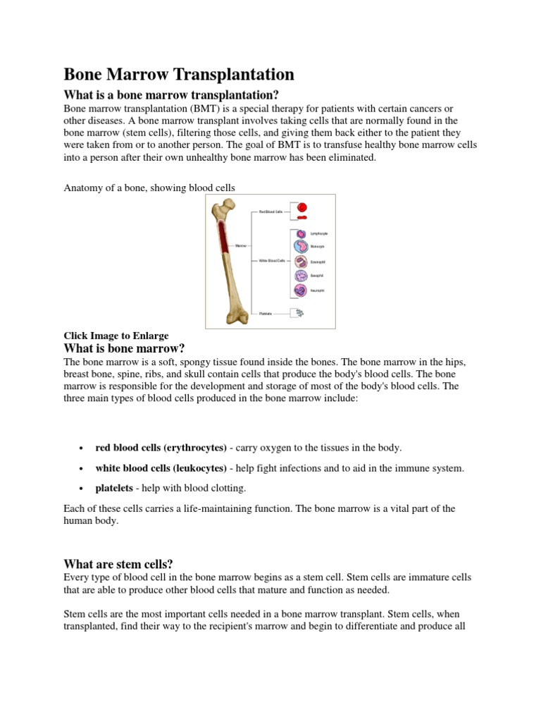 Bone Marrow Transplantation | Download Free PDF | Hematopoietic Stem ...