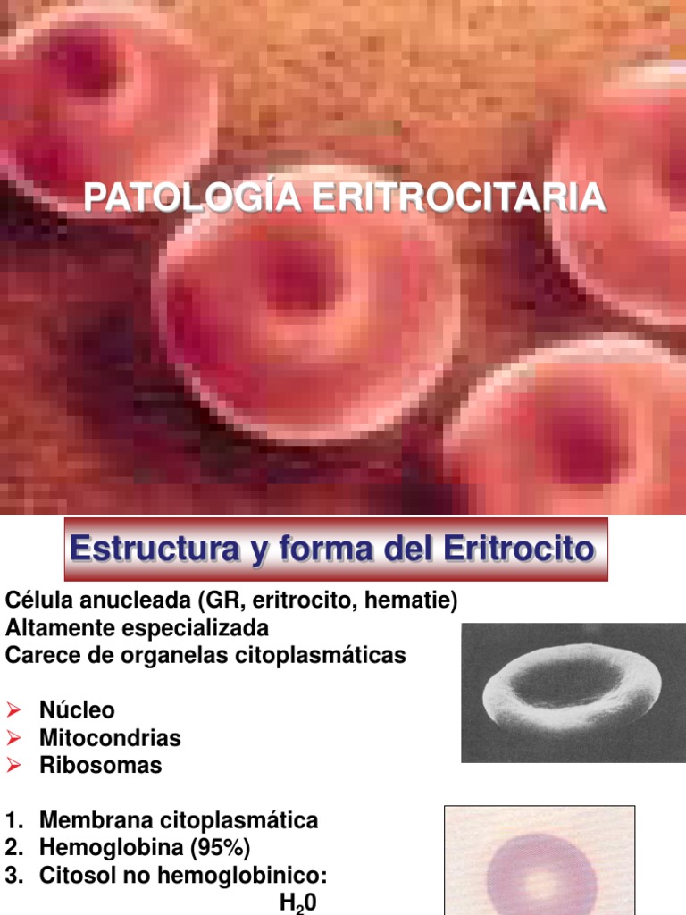 Patología Eritrocitaria | Glóbulo rojo | Enfermedades y trastornos