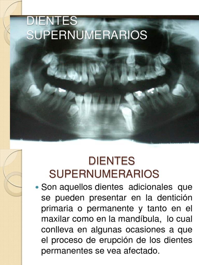 Dientes Supernumerarios | PDF | Diente humano | Diente