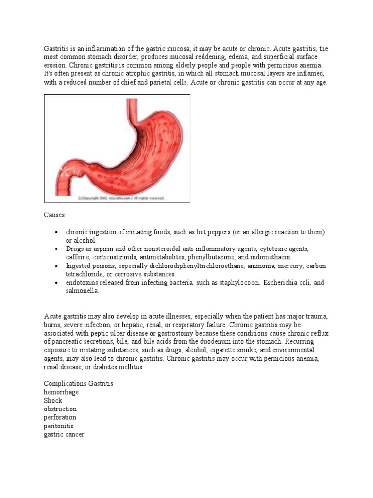 Gastritis is an Inflammation of the Gastric Mucosa | Stomach | Nausea