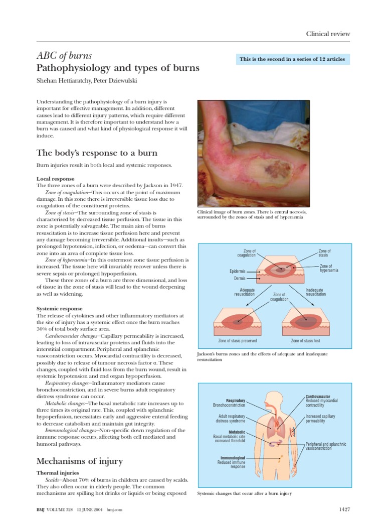 Understanding Burn Injury Pathophysiology | PDF