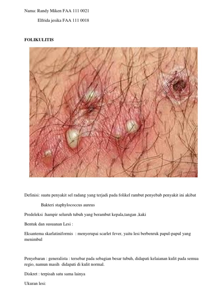 Laporan Folikulitis | PDF