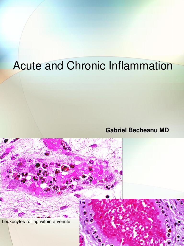 Acute and Chronic Inflammation: Gabriel Becheanu MD | PDF | Complement System | Inflammation